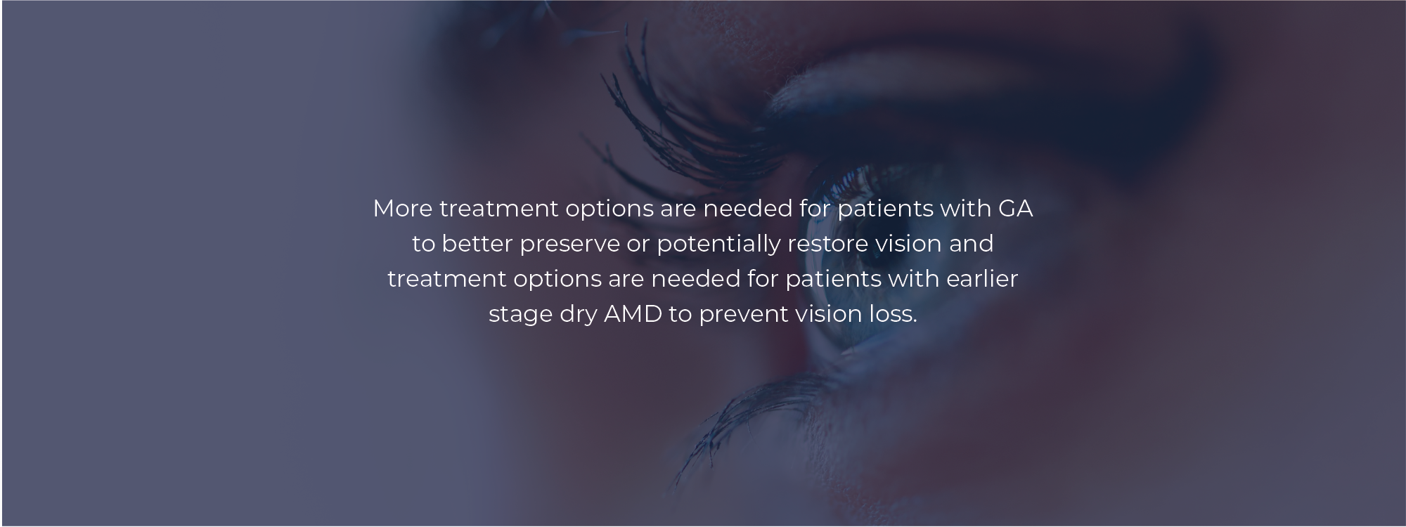 WAMD - Wet Age Related Macular Degeneration - Kodiak Sciences